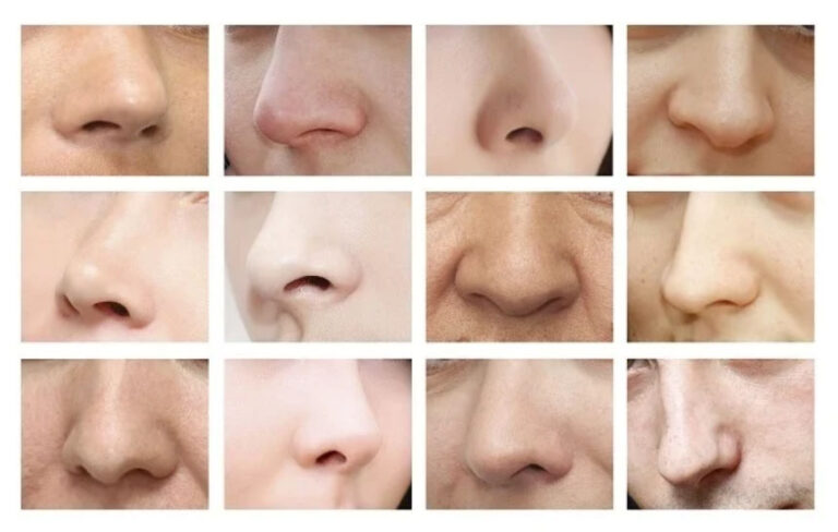 Types and Shapes of Noses: Exploring the Diversity - Blog Aram Clinic