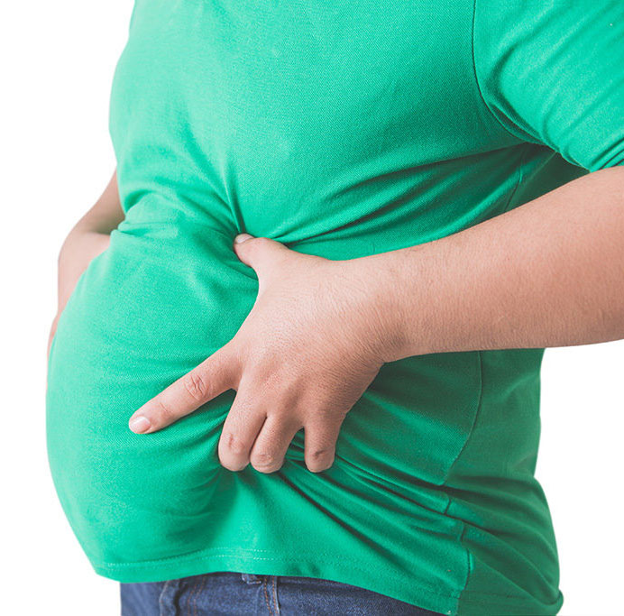 Obésité : surpoids excessif avec IMC > 30 - Obésité sévère et morbide